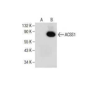 Anti-ACSS1 Antibody (D-7) | SCBT - Santa Cruz Biotechnology