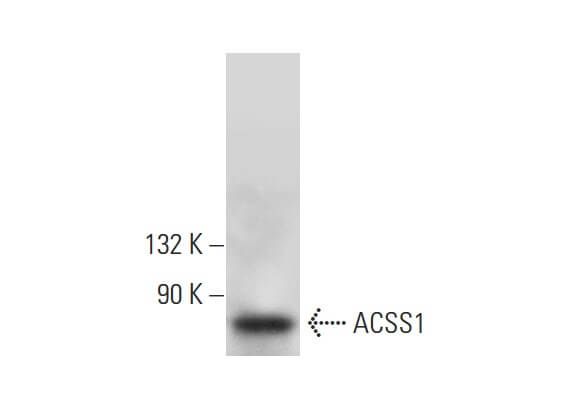 ACSS1 Antibody (D-7) | SCBT - Santa Cruz Biotechnology