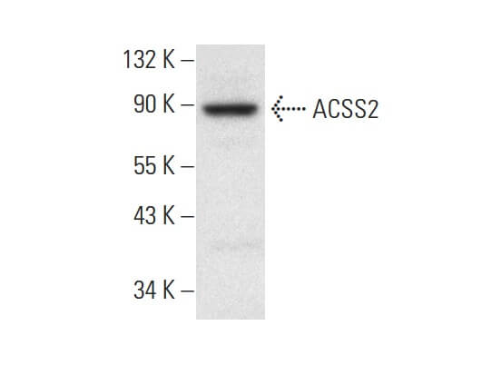 Anti-ACSS2 Antibody (A-9) | SCBT - Santa Cruz Biotechnology
