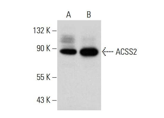 ACSS2抗体 (A-9) | SCBT - Santa Cruz Biotechnology