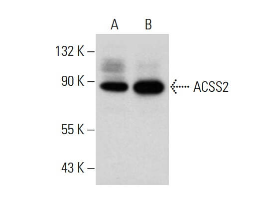 Anti-ACSS2 Antibody (A-9) | SCBT - Santa Cruz Biotechnology