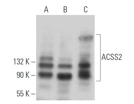 Anti-ACSS2 Antibody (A-9) | SCBT - Santa Cruz Biotechnology