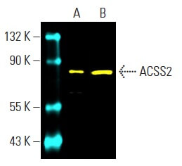 Anti-ACSS2 Antibody (A-9) | SCBT - Santa Cruz Biotechnology