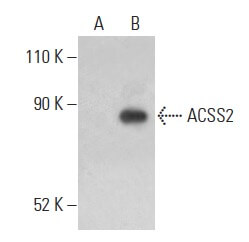 Anti-ACSS2 Antibody (A-9) | SCBT - Santa Cruz Biotechnology