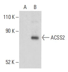 Anti-ACSS2 Antibody (A-9) | SCBT - Santa Cruz Biotechnology