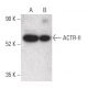 Anti-ACTR-II Antibody (F-12) | SCBT - Santa Cruz Biotechnology