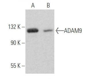 Anti-ADAM9 Antibody (G-1) | SCBT - Santa Cruz Biotechnology