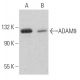 Anti-ADAM9 Antibody (G-1) | SCBT - Santa Cruz Biotechnology
