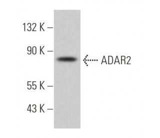 ADAR2 Antibody (F-9) - Western Blotting - Image 361875