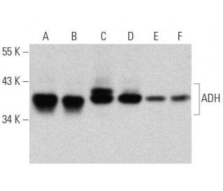 ADH Antibody (H-300) | SCBT - Santa Cruz Biotechnology
