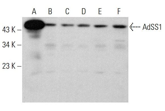 AdSS1 Antibody (G-9) | SCBT - Santa Cruz Biotechnology