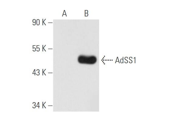 AdSS1 Antibody (H-2) | SCBT - Santa Cruz Biotechnology