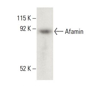 Afamin Antibody (G-10) | SCBT - Santa Cruz Biotechnology