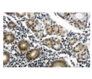 AFP/Alpha fetoprotein Antibody (39) | SCBT - Santa Cruz Biotechnology