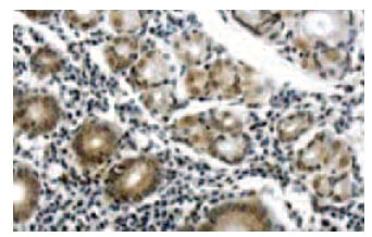 AFP/Alpha fetoprotein Antibody (39) | SCBT - Santa Cruz Biotechnology