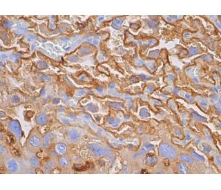 AFP Antibody (39) - Immunohistochemistry - Image 387545