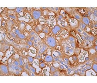 AFP Antibody (39) - Immunohistochemistry - Image 387546