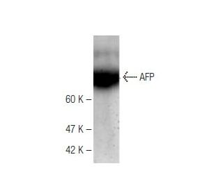 AFP Antibody (39) - Western Blotting - Image 67398