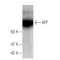 AFP/Alpha fetoprotein Antibody (39) | SCBT - Santa Cruz Biotechnology