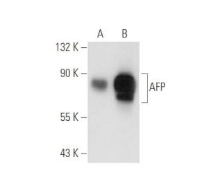 AFP Antibody (39) - Western Blotting - Image 80708