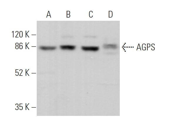 AGPS Antibody (A-2) | SCBT - Santa Cruz Biotechnology