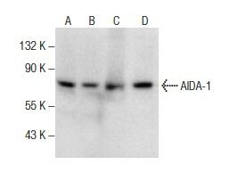 AIDA-1 Antibody (C-10) | SCBT - Santa Cruz Biotechnology