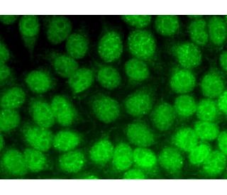 AIM2 Antibody (B-8) - Immunofluorescence - Image 370530
