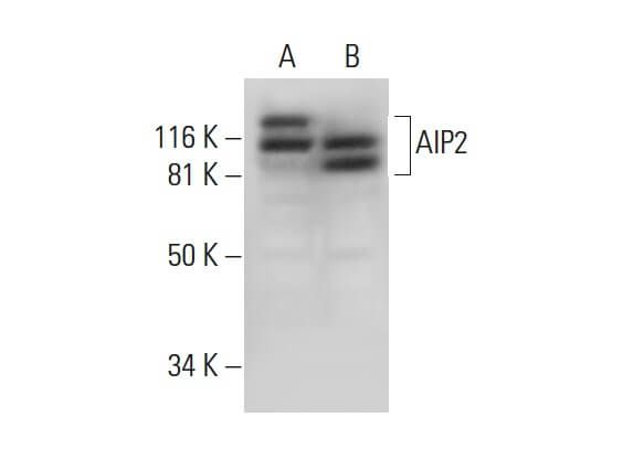 AIP2抗体 (G-9) | SCBT - Santa Cruz Biotechnology