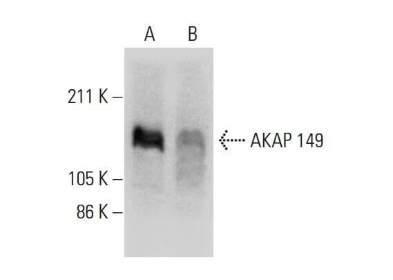 AKAP 149抗体 (H-8) | SCBT - Santa Cruz Biotechnology