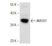 Anti-AKR1D1 Antibody (A-7) | SCBT - Santa Cruz Biotechnology