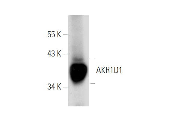 Anti-AKR1D1 Antibody (A-7) | SCBT - Santa Cruz Biotechnology