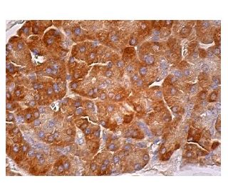 Anti-AlaRS Antibody (A-6) | SCBT - Santa Cruz Biotechnology