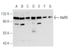 Anti-AlaRS Antibody (A-6) | SCBT - Santa Cruz Biotechnology