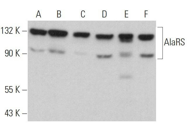 Anti-AlaRS Antibody (A-6) | SCBT - Santa Cruz Biotechnology