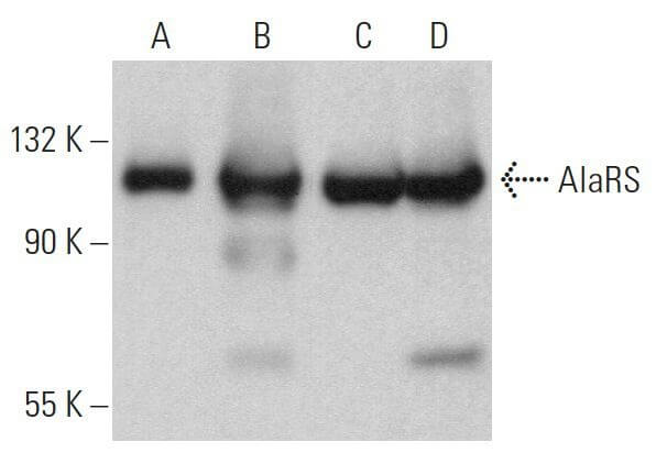 AlaRS Antibody (E-9) | SCBT - Santa Cruz Biotechnology
