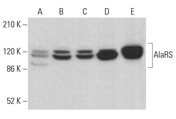 AlaRS抗体 (H-5) | SCBT - Santa Cruz Biotechnology