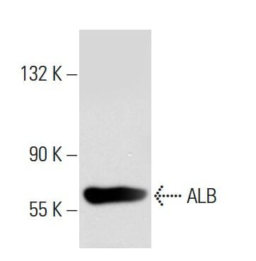 ALB/Albumin Antibody (AL-01) | SCBT - Santa Cruz Biotechnology