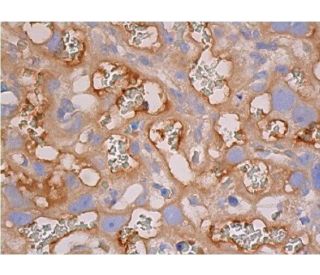 ALB Antibody (F-8) - Immunohistochemistry - Image 354213
