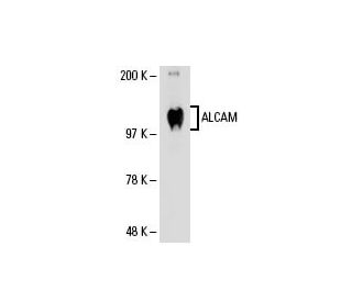 ALCAM Antibody (H-9) | SCBT - Santa Cruz Biotechnology