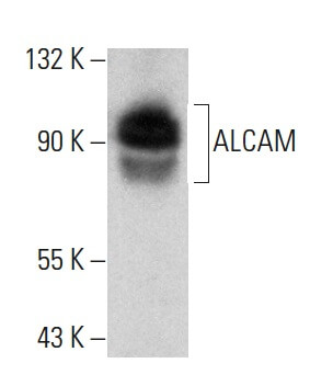 ALCAM Antibody (H-9) | SCBT - Santa Cruz Biotechnology