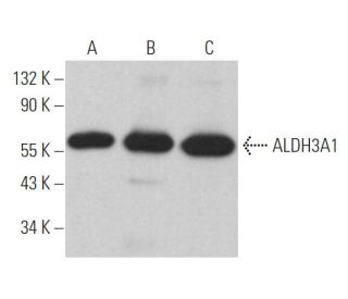 Aldehyde dehydrogenase 3-A1/ALDH3A1 CRISPR/Cas9 KO Plasmid (m) | SCBT ...