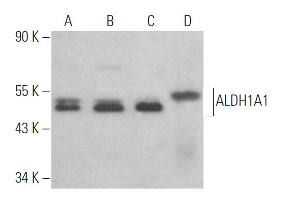 Anti-Aldehyde dehydrogenase 1-A1/ALDH1A1 Antibody (A-6) | SCBT - Santa ...