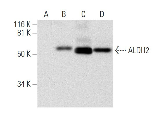 Aldehyde dehydrogenase 1-A2/ALDH1A2 Antibody (G-2) | SCBT - Santa Cruz ...