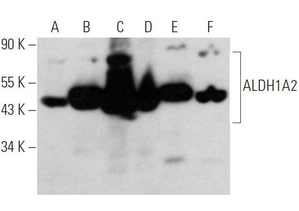 Aldehyde dehydrogenase 1-A2/ALDH1A2 Antibody (G-2) | SCBT - Santa Cruz ...