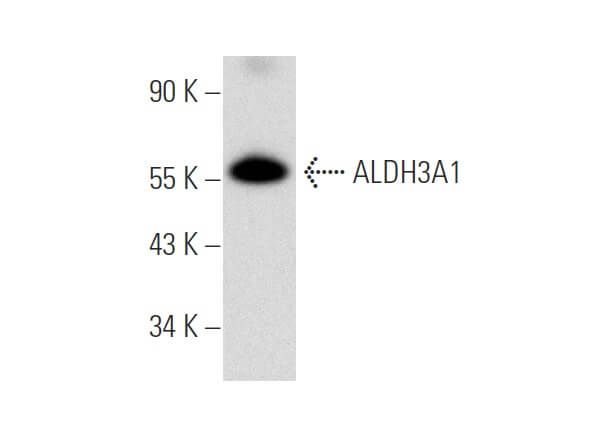 Aldehyde dehydrogenase 3-A1/ALDH3A1 Antibody (E-11) | SCBT - Santa Cruz ...