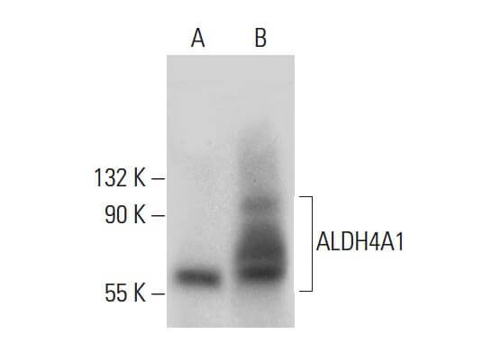 Aldehyde dehydrogenase 4-A1/P5CDH/ALDH4A1 Antibody (E-11) | SCBT ...