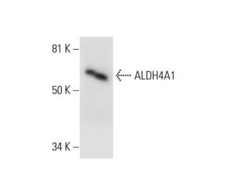 Anti-Aldehyde dehydrogenase 4-A1/P5CDH/ALDH4A1 Antibody (E-4) | SCBT ...