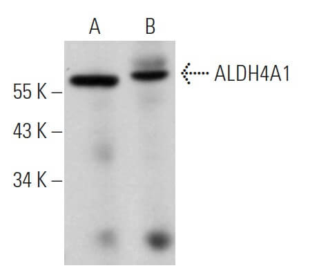 Aldehyde dehydrogenase 4-A1/P5CDH/ALDH4A1 Antibody (H-6) | SCBT - Santa ...