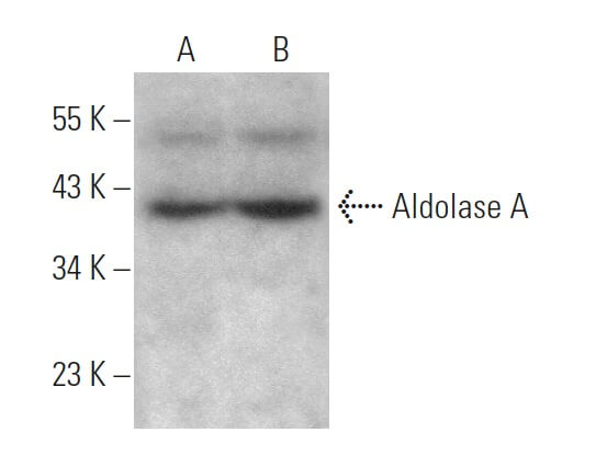 Anti-Aldolase A Antibody (C-10) | SCBT - Santa Cruz Biotechnology