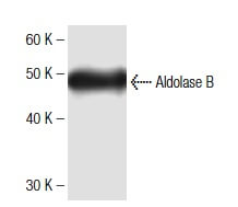 Aldolase B Antibody (19) | SCBT - Santa Cruz Biotechnology